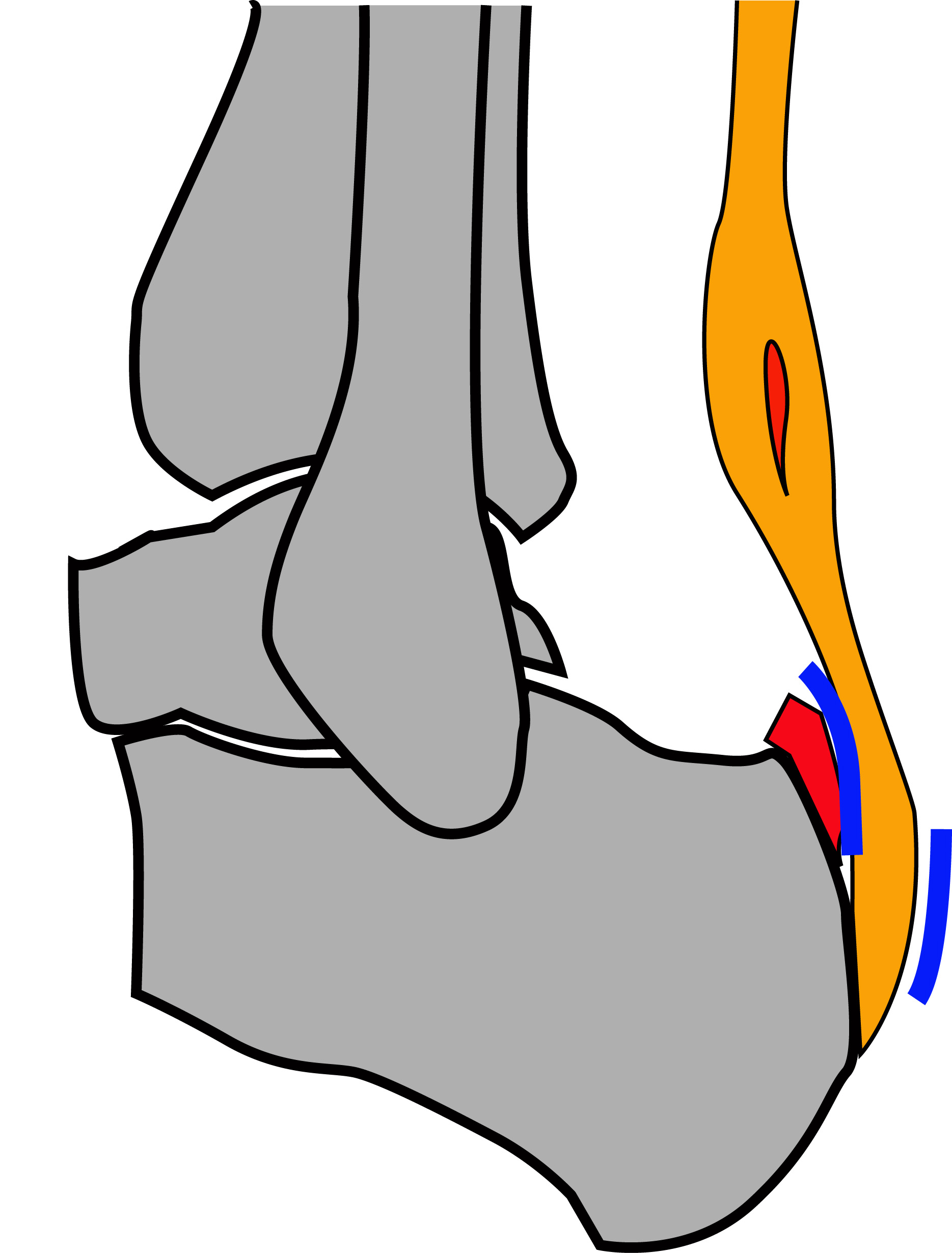 Achillessehne – OGAM Orthopädie