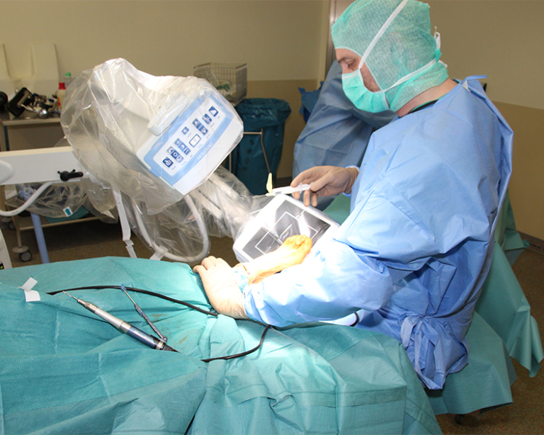 Knochenentnahme vom Beckenkamm - OGAM Orthopädie